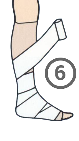 Zwachtelen van de benen | eMJe - Elastische kousen